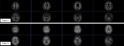 News | Benson Radiology